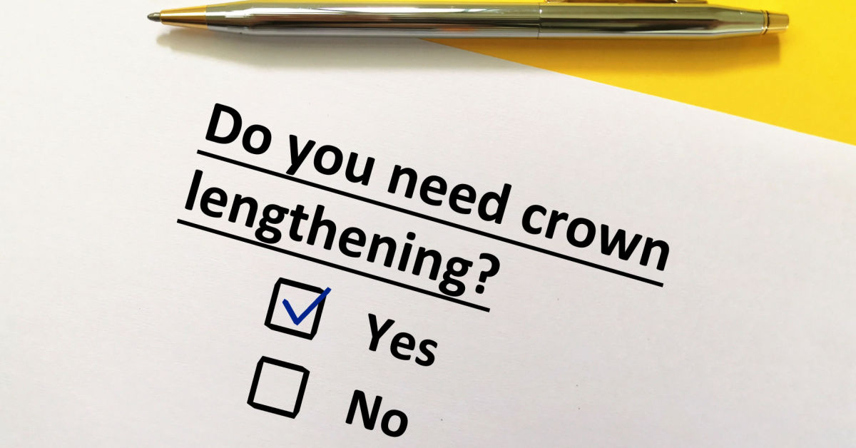 Crown Lengthening: Reasons, Process, Benefits | Suburban Essex Dental